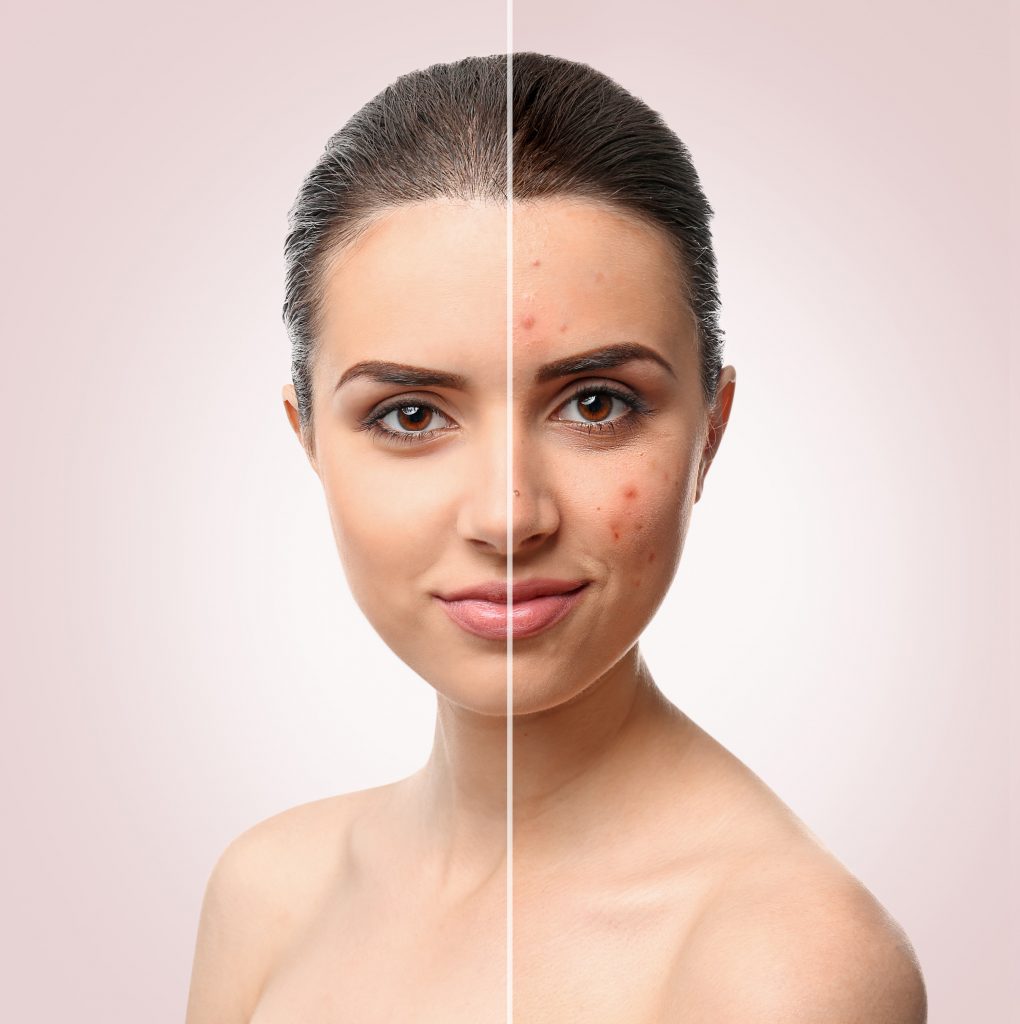 Best Skin Specialist Doctors in Hyderabad | Best Dermatologists in Hyd